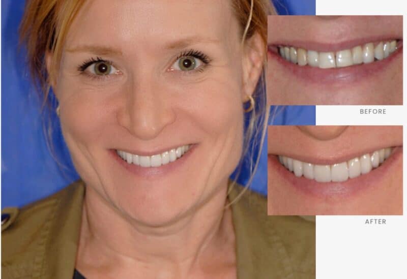 Smile Gallery - Stonebriar Smile